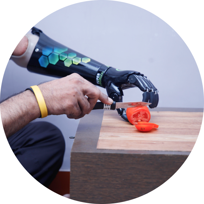 Modern prosthetic hands